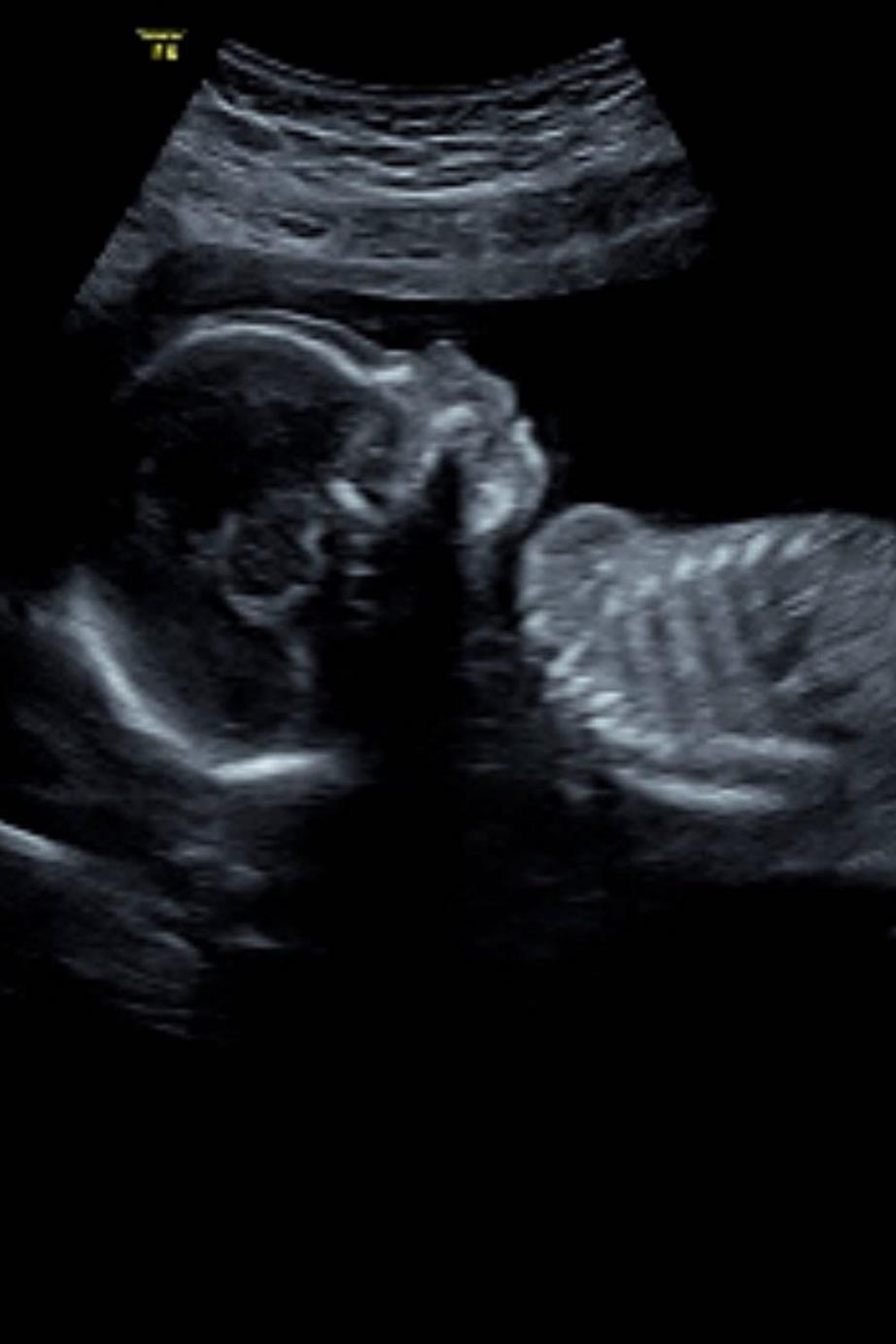 The Honey Badger and Fiancée Alexandra George Welcome Baby