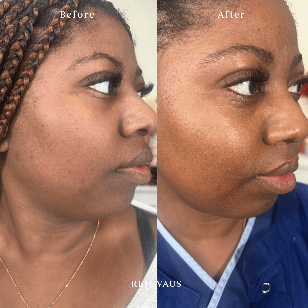 Rejuvaus' Refine & Repair ABC Serum is loved by your fave celebs